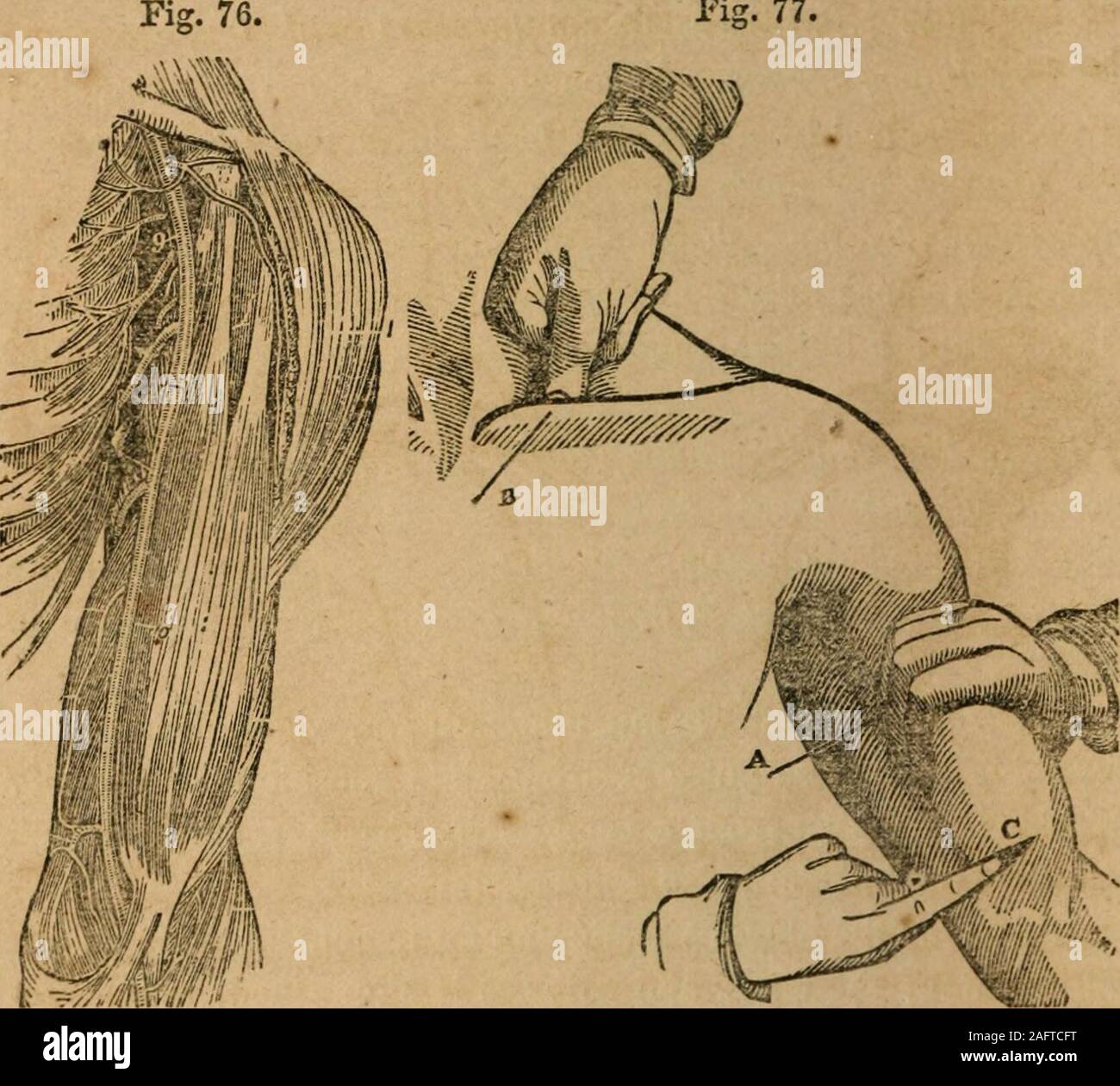 Vitiated air hi-res stock photography and images - Alamy