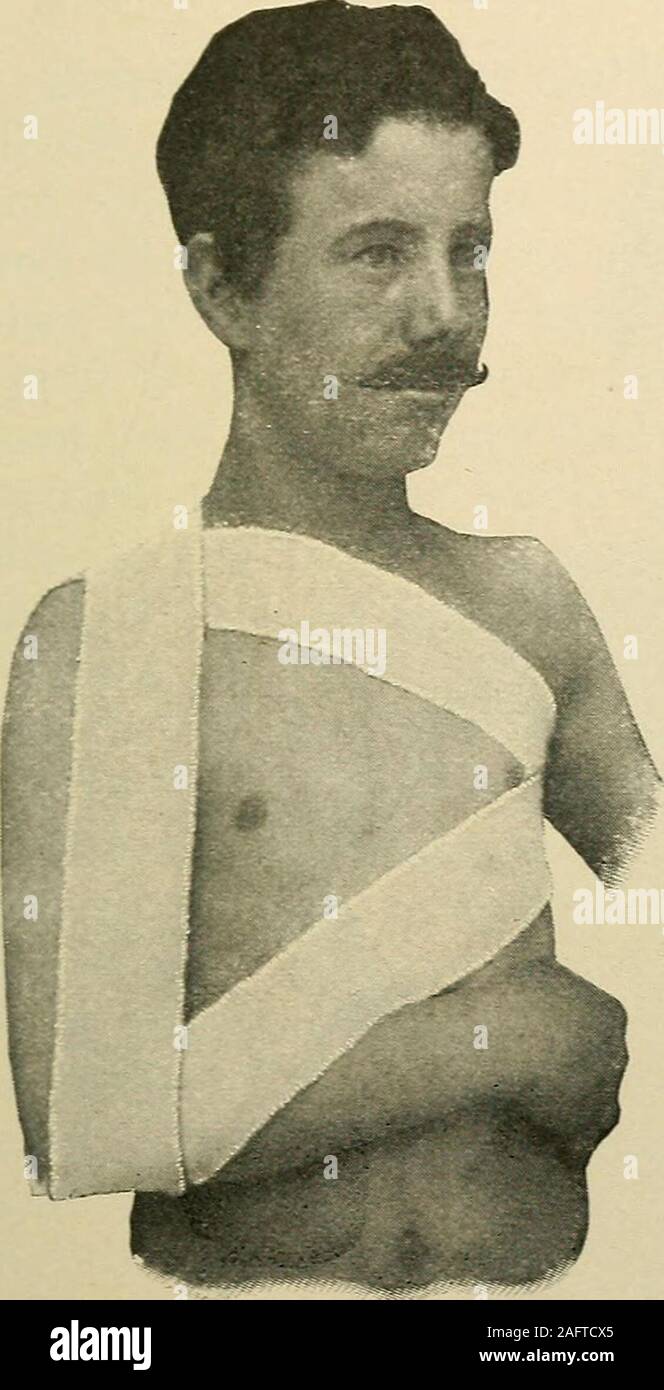 . Minor surgery and bandaging; including the treatment of fractures and ...