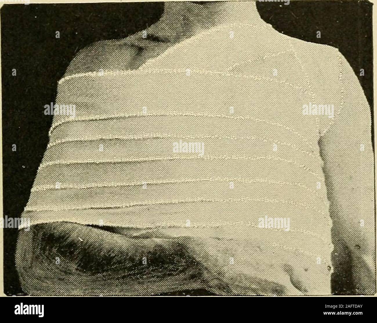 . Minor surgery and bandaging; including the treatment of fractures and ...