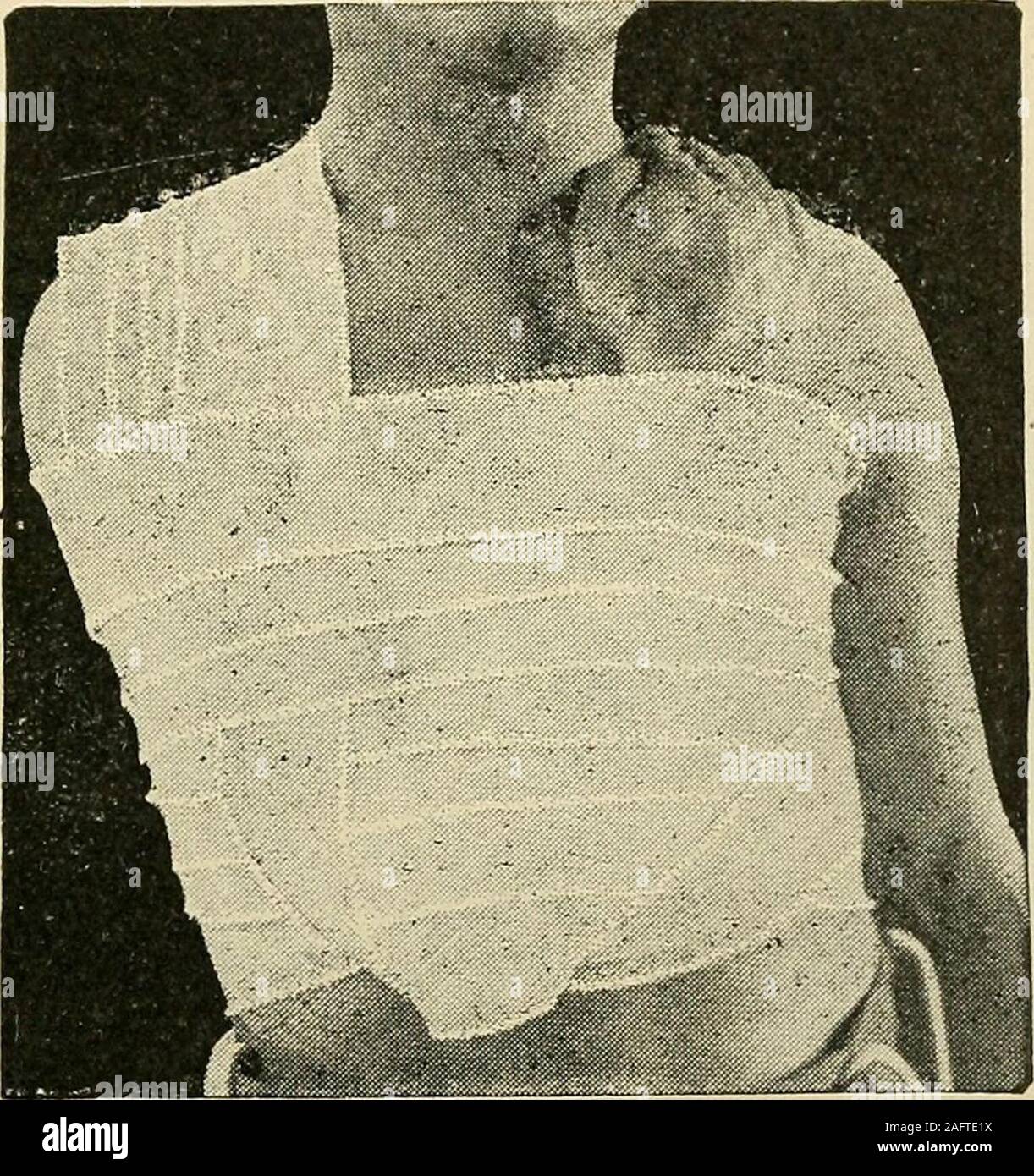 . Minor surgery and bandaging; including the treatment of fractures and ...
