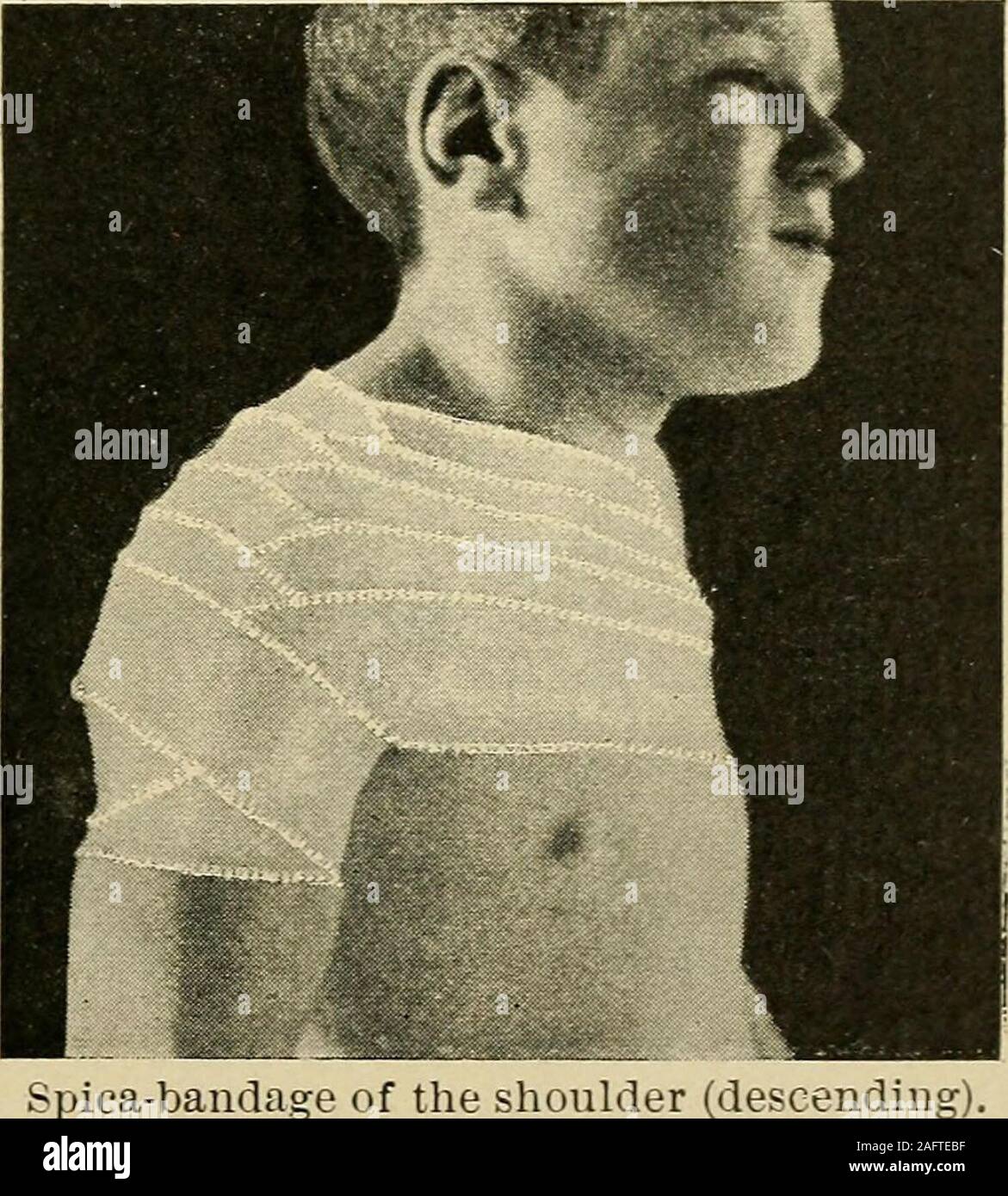 . Minor surgery and bandaging; including the treatment of fractures and ...