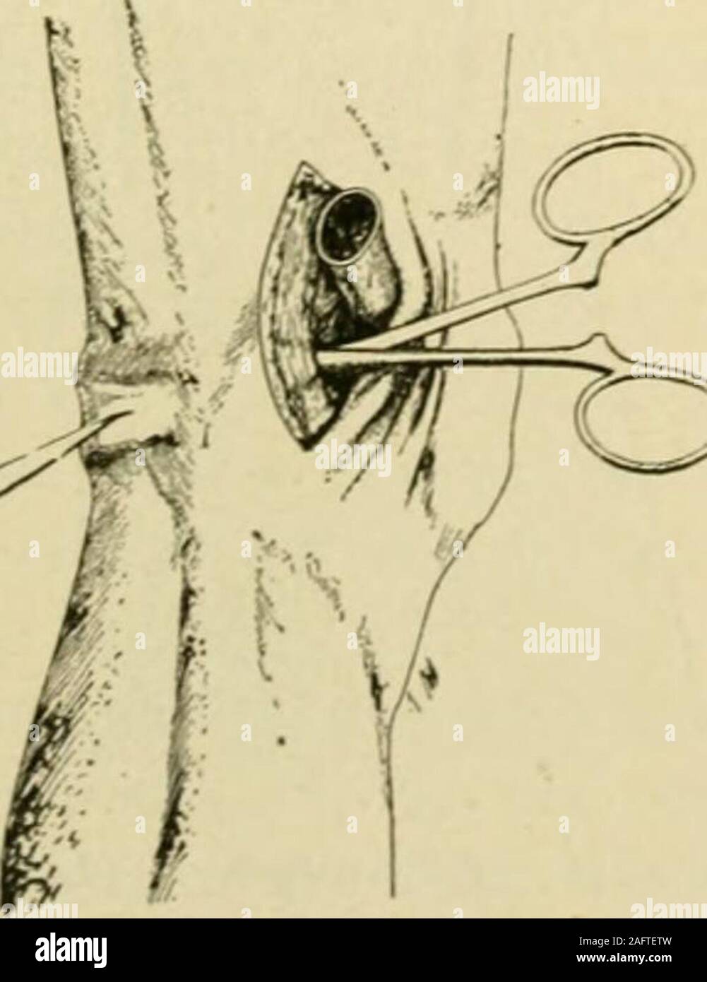. Manual of operative surgery. lis. (B) The above incisions may not ...