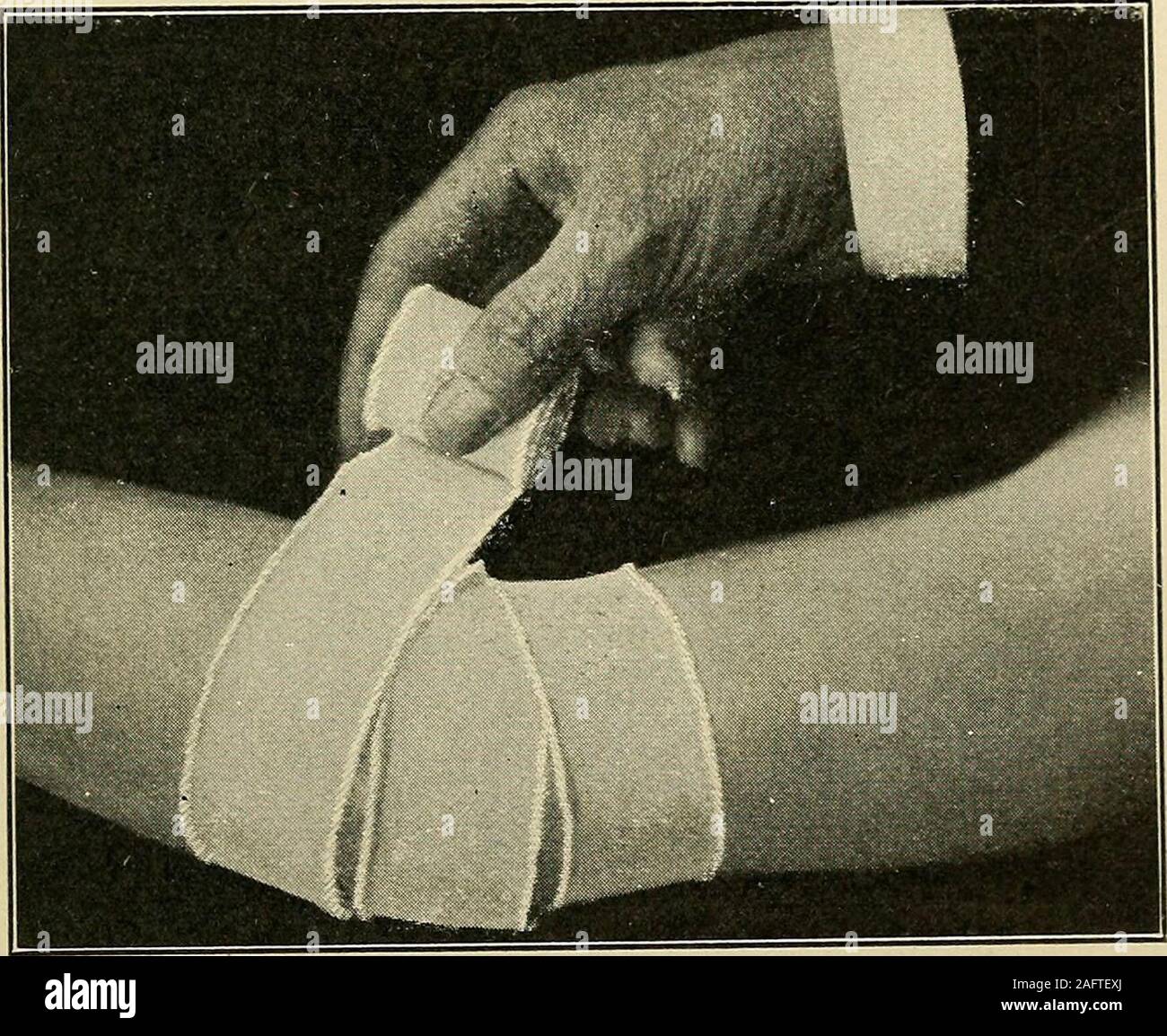 . Minor surgery and bandaging; including the treatment of fractures and ...