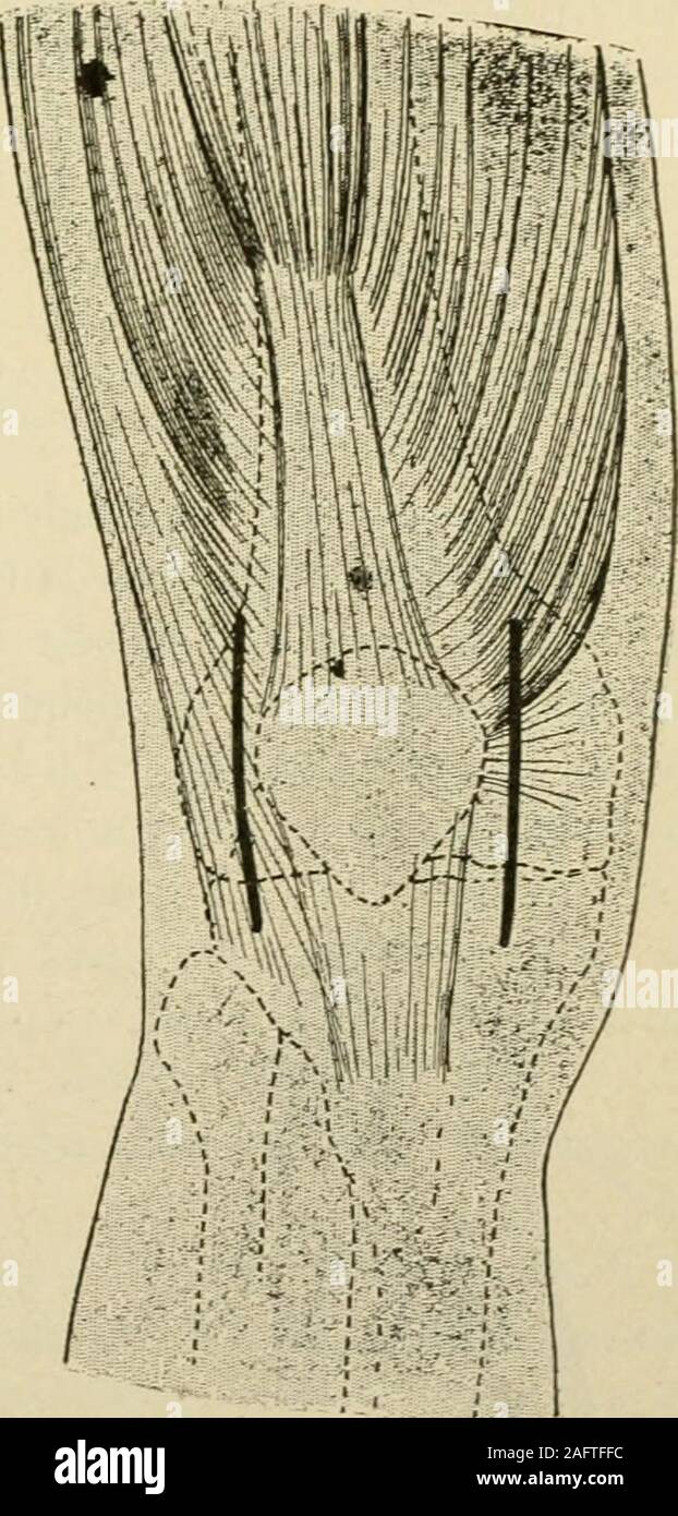 . Manual of operative surgery. the method. Arthrotomy Knee.—Arthrotomy ...