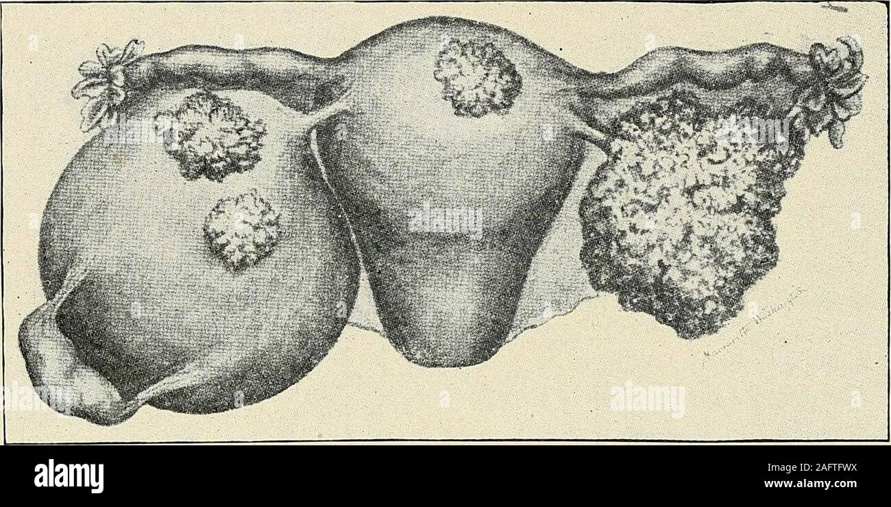 . The diagnosis and treatment of diseases of women. Fig. 632. A ...