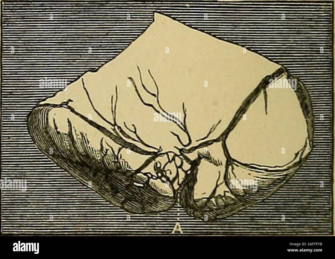 . Diseases of the heart and thoracic aorta. Fig. I.—Heart of Dugong ...