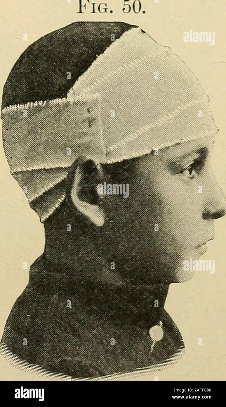 . Minor surgery and bandaging; including the treatment of fractures and ...