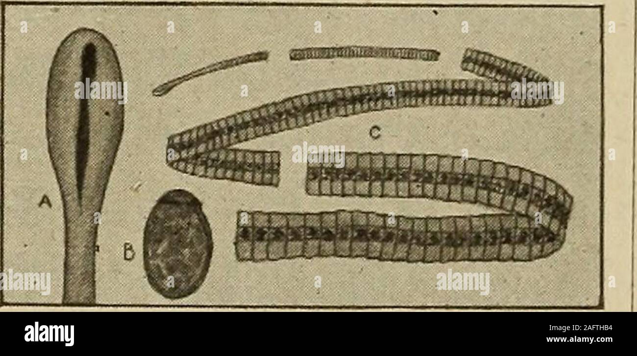 Hymenolepis Diminuta Labeled