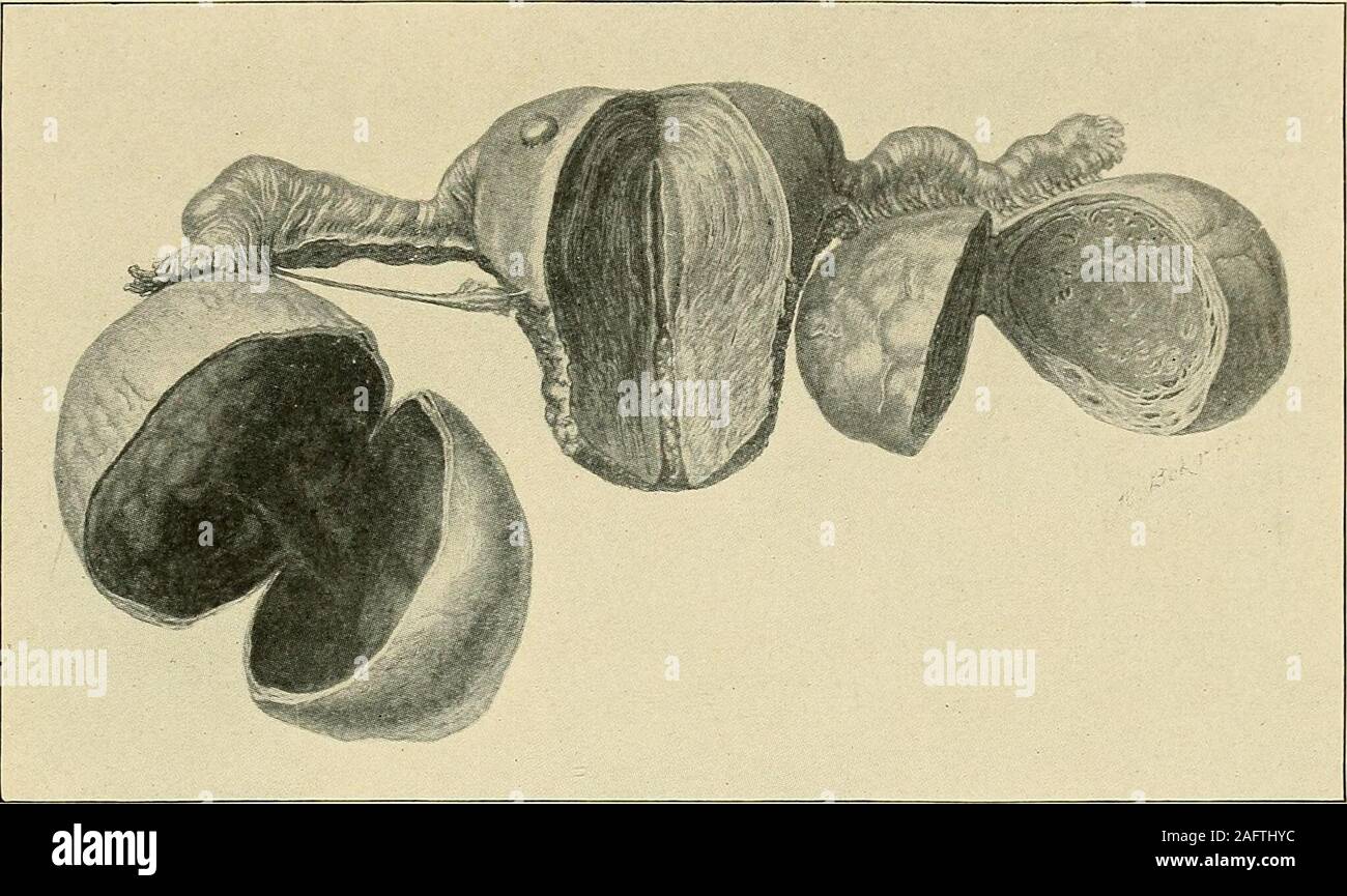 . The diagnosis and treatment of diseases of women. Fig. 657 ...