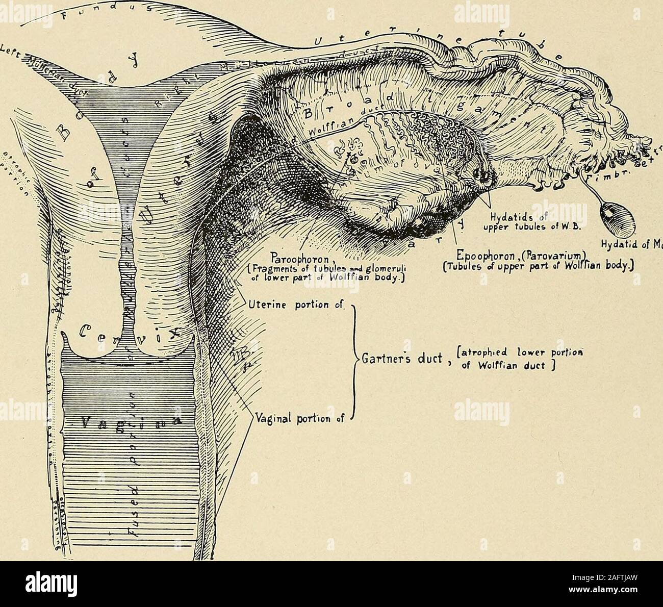 . The diagnosis and treatment of diseases of women. Duct of Mueller ...