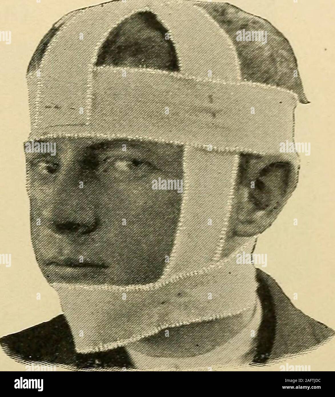 . Minor surgery and bandaging; including the treatment of fractures and ...