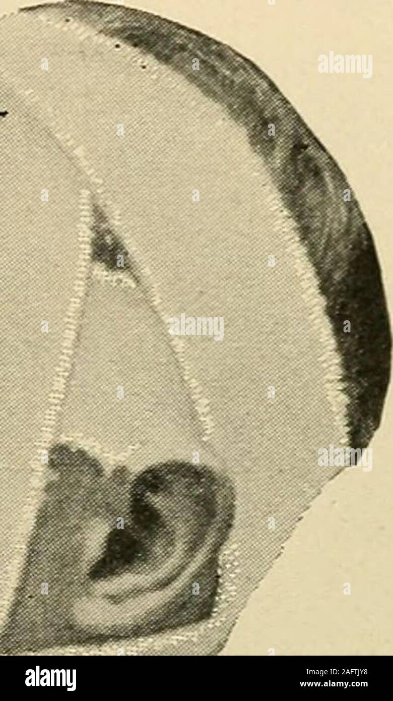 . Minor surgery and bandaging; including the treatment of fractures and ...