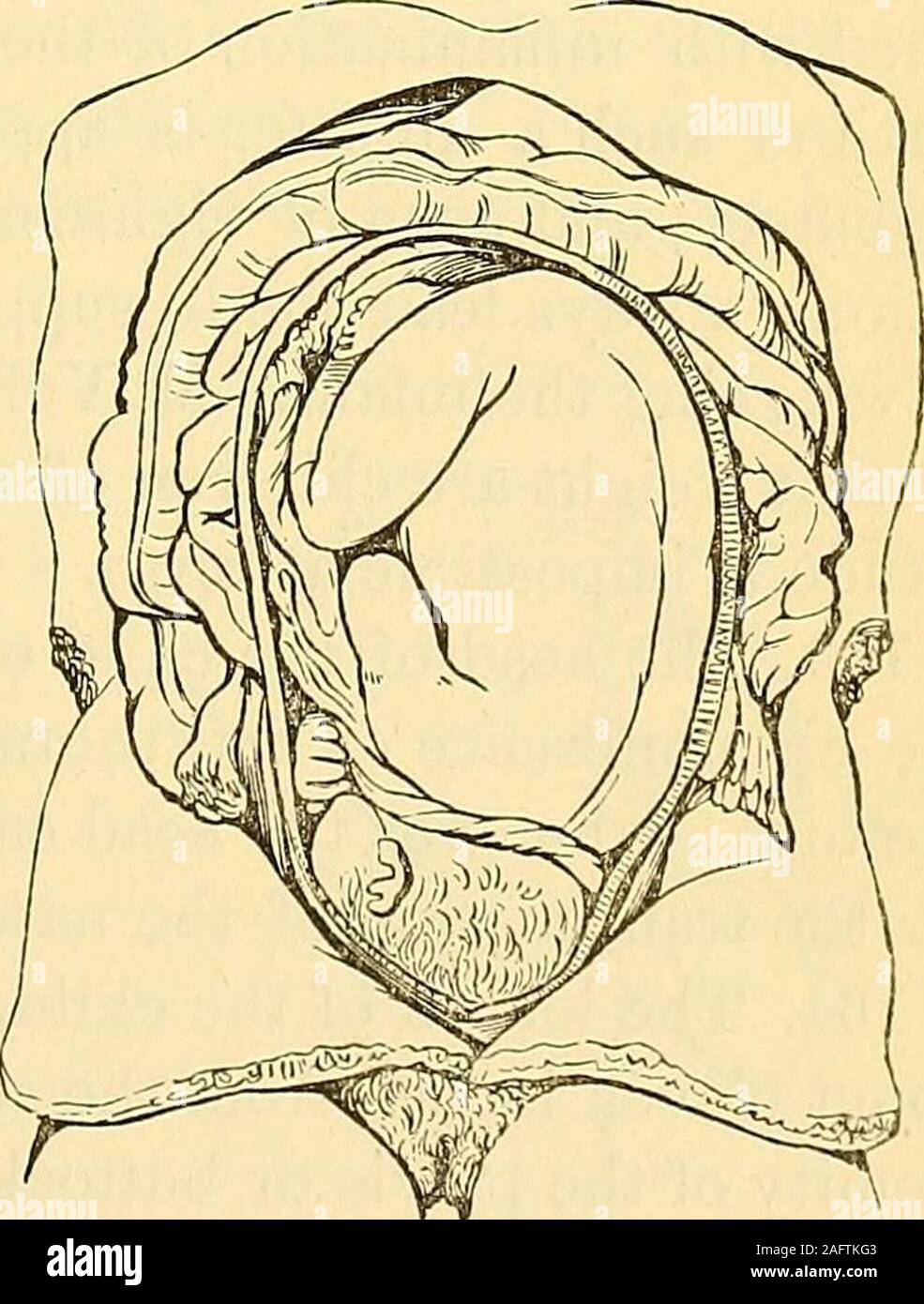 Cephalic position hi-res stock photography and images - Alamy
