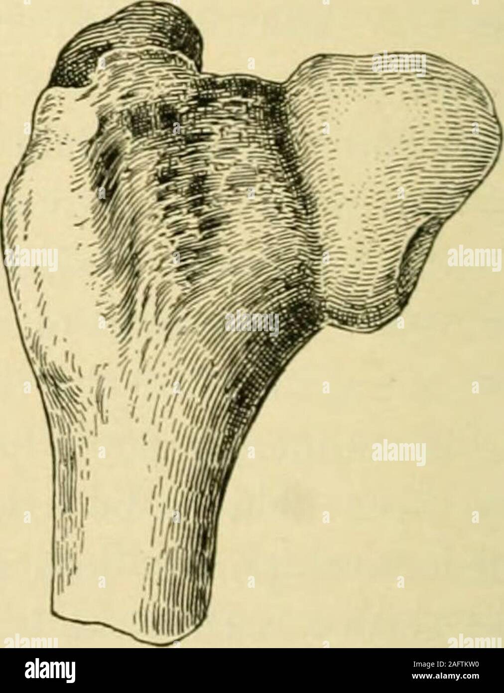 . Manual of operative surgery. Fig. 1250. Fig. 12^I. cartilage becomes ...