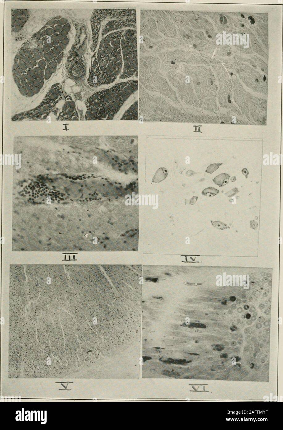 Normal appearance of spinal cord hi-res stock photography and images ...