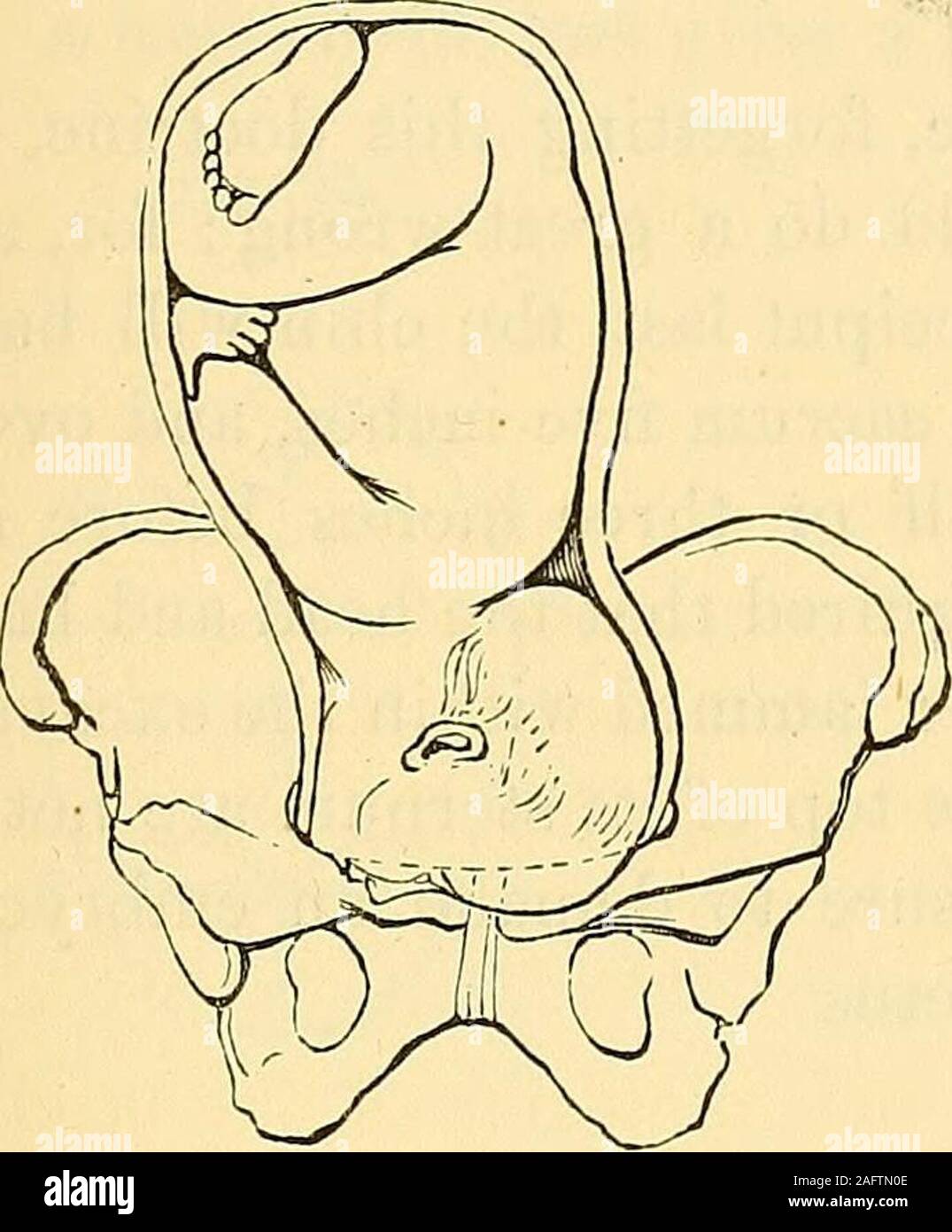 Pelvis rotation hi-res stock photography and images - Alamy