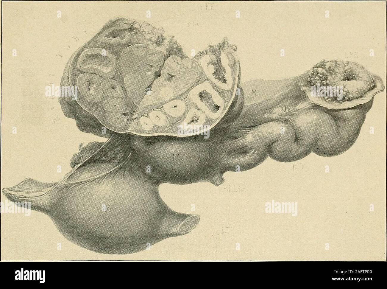 . The diagnosis and treatment of diseases of women. Fig. 637. Pelvic ...