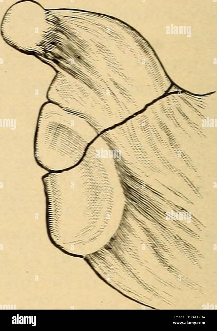 Coracoid process hi-res stock photography and images - Alamy