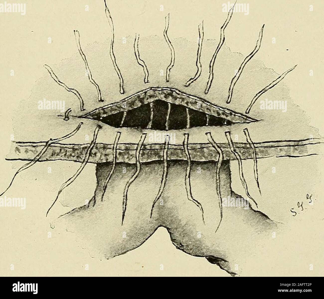. Diseases of the rectum and anus: designed for students and ...