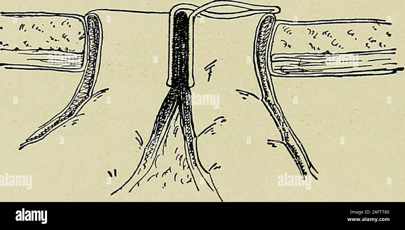 . Diseases of the rectum and anus: designed for students and ...