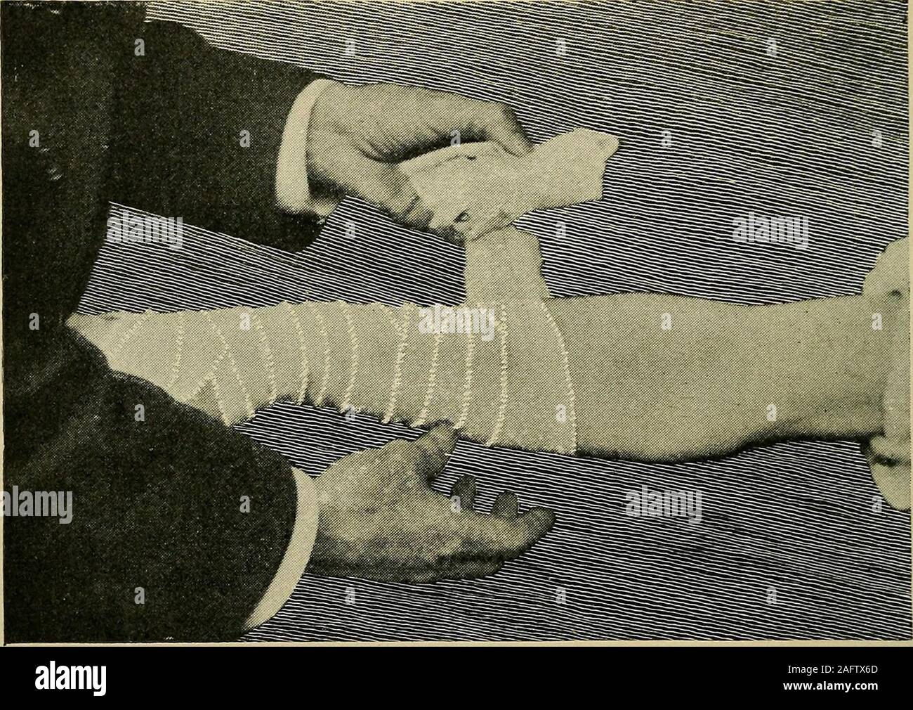 . Minor surgery and bandaging; including the treatment of fractures and ...
