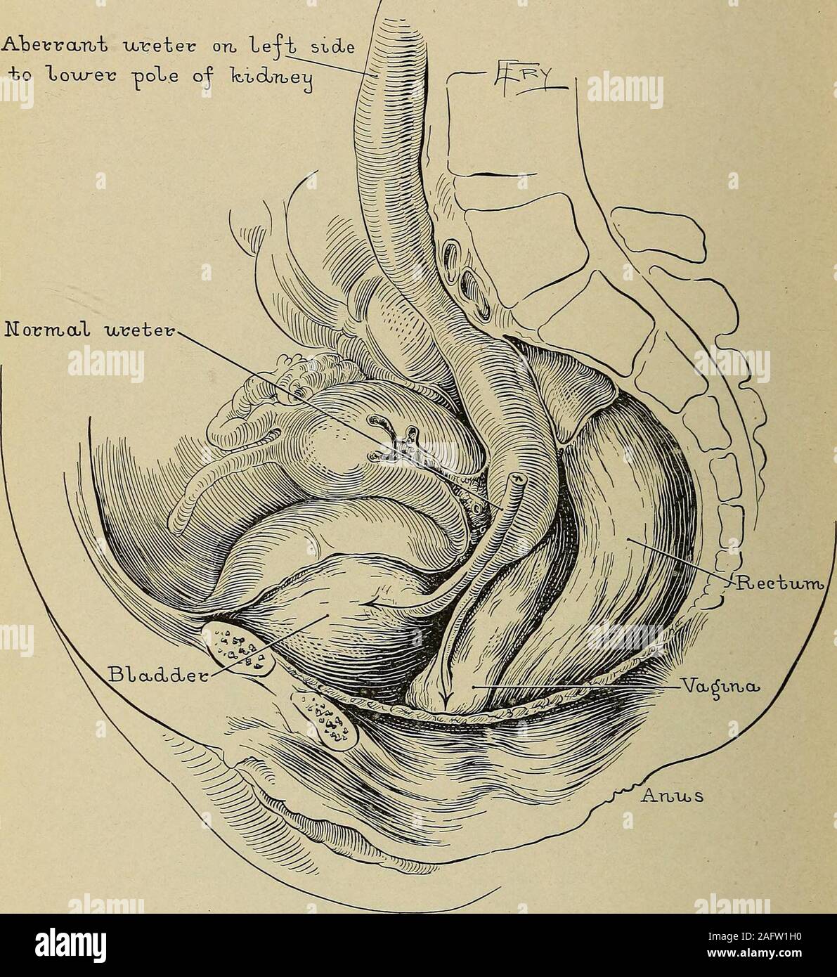 Pig bladder hi-res stock photography and images - Alamy