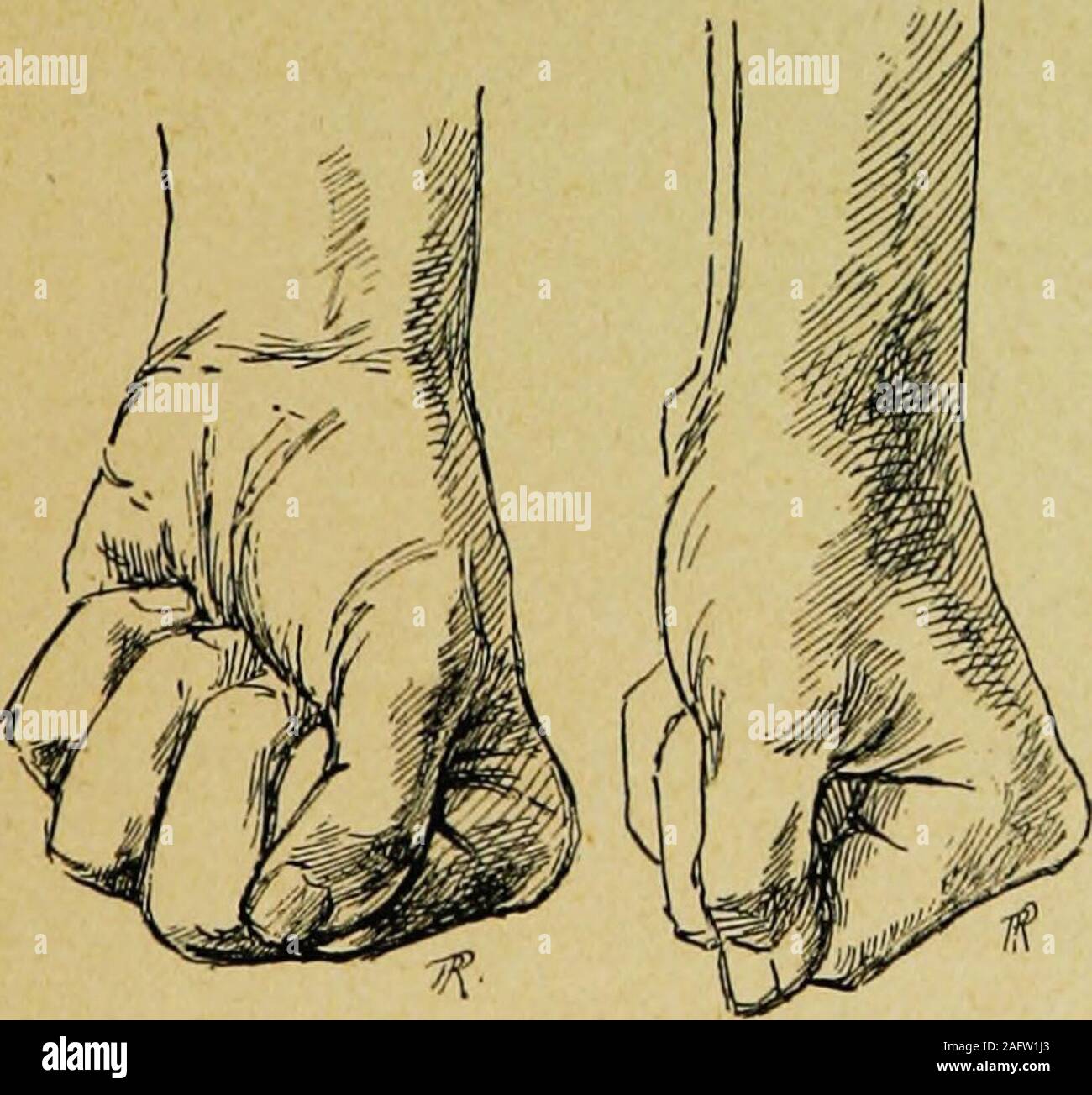 Extension du bras hi-res stock photography and images - Alamy