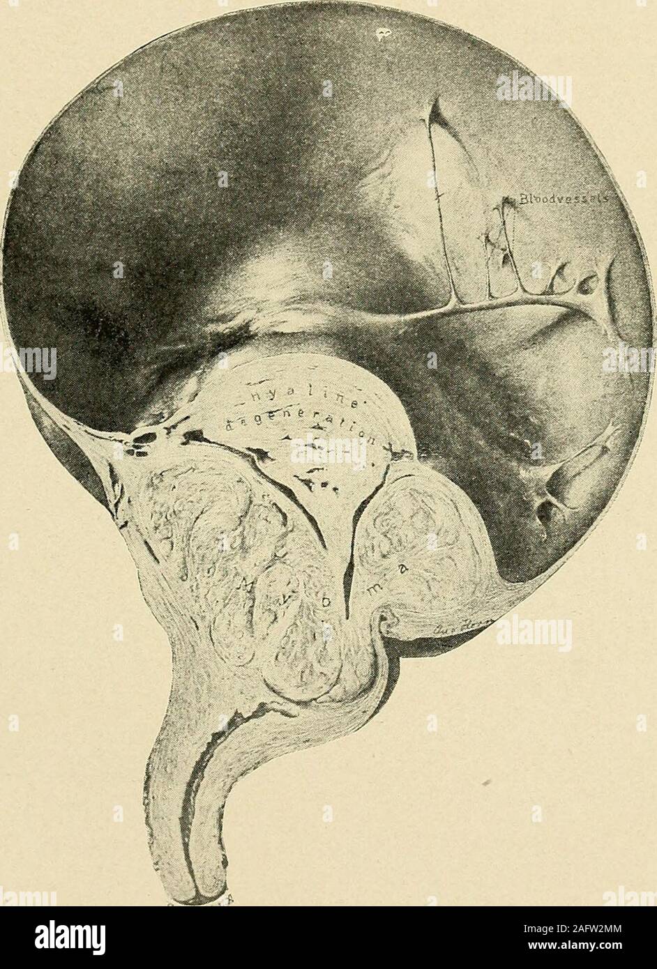 . The diagnosis and treatment of diseases of women. P Fig. 611. A ...