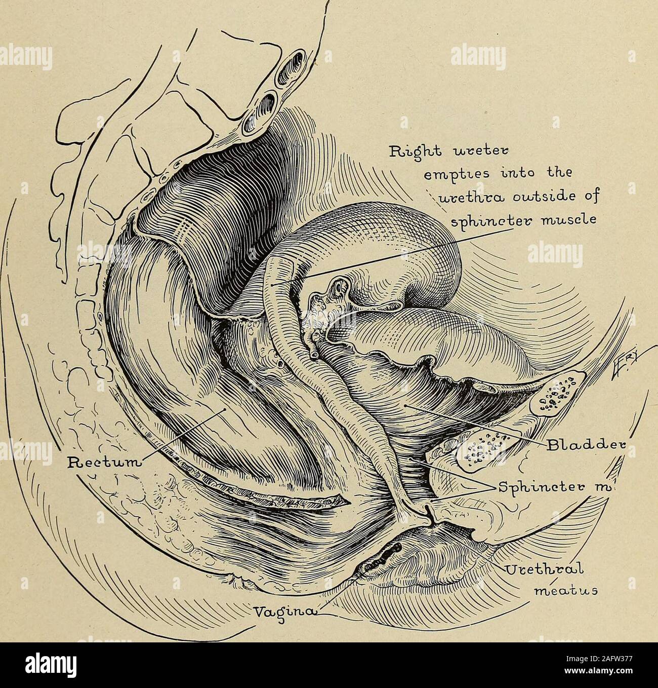 . Transactions of the Western Surgical Association. internal sphincter ...