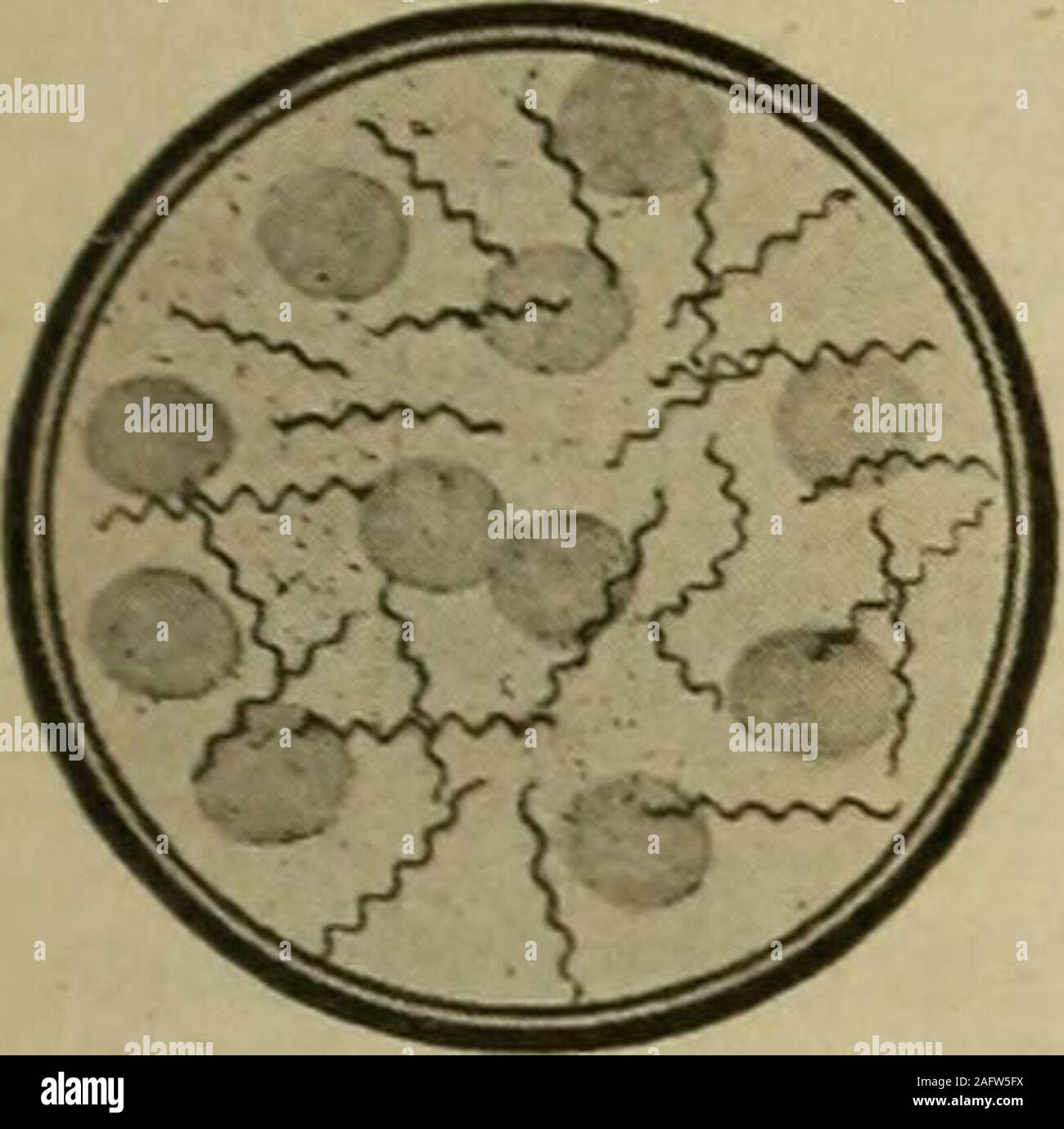 Acute onset of fever hi-res stock photography and images - Alamy