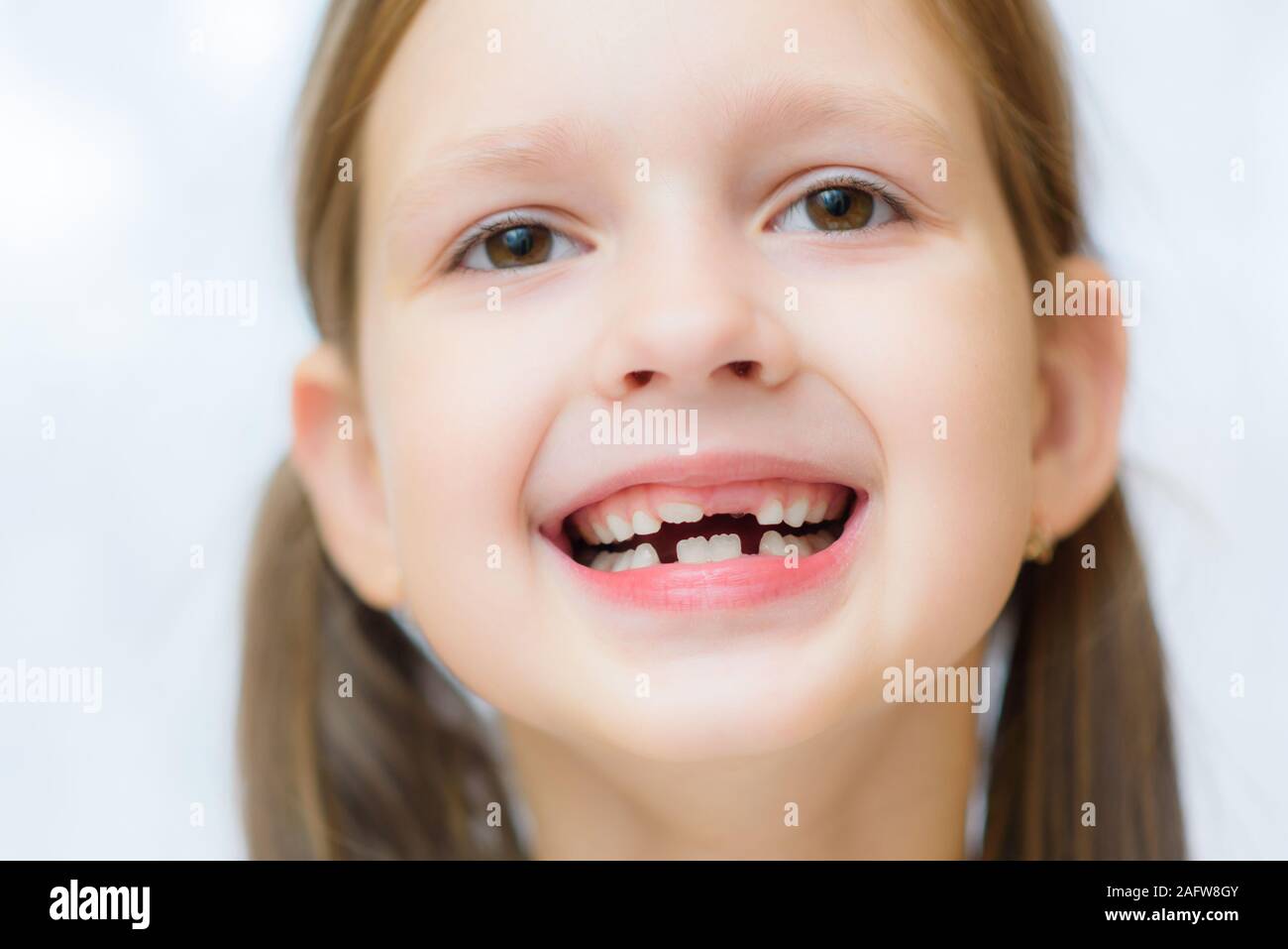 funny toothless girl laughing in his room Stock Photo - Alamy