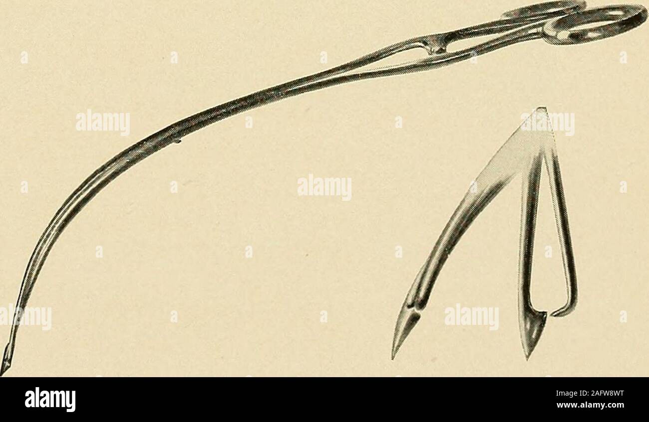 . The diagnosis and treatment of diseases of women. wall. The giasping ...