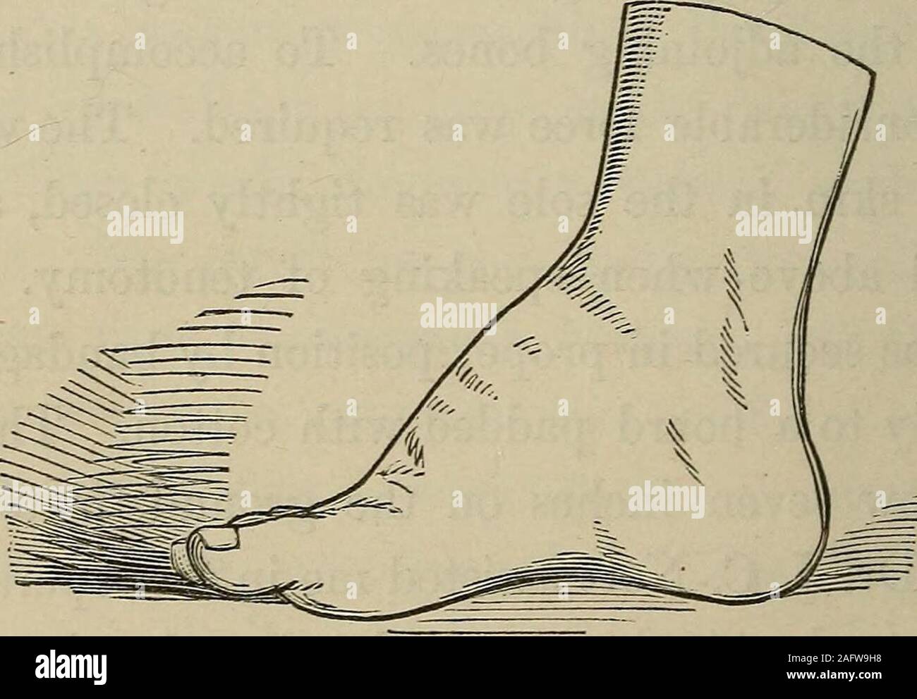 Periost hi-res stock photography and images - Alamy