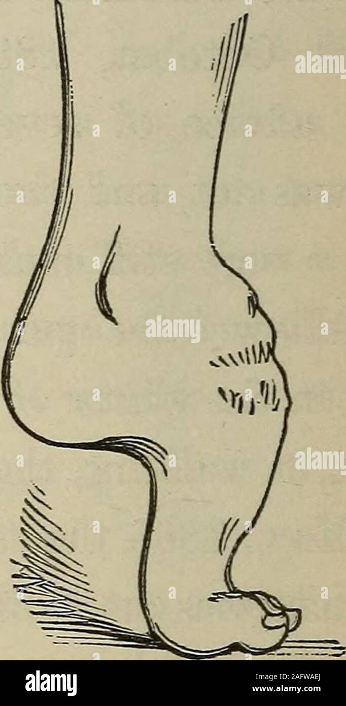 Instep board hi-res stock photography and images - Alamy