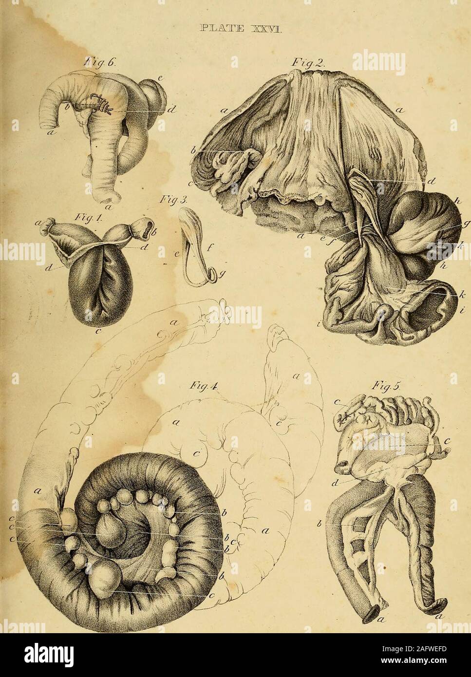 . The anatomy and surgical treatment of abdominal hernia. Ex-periments ...