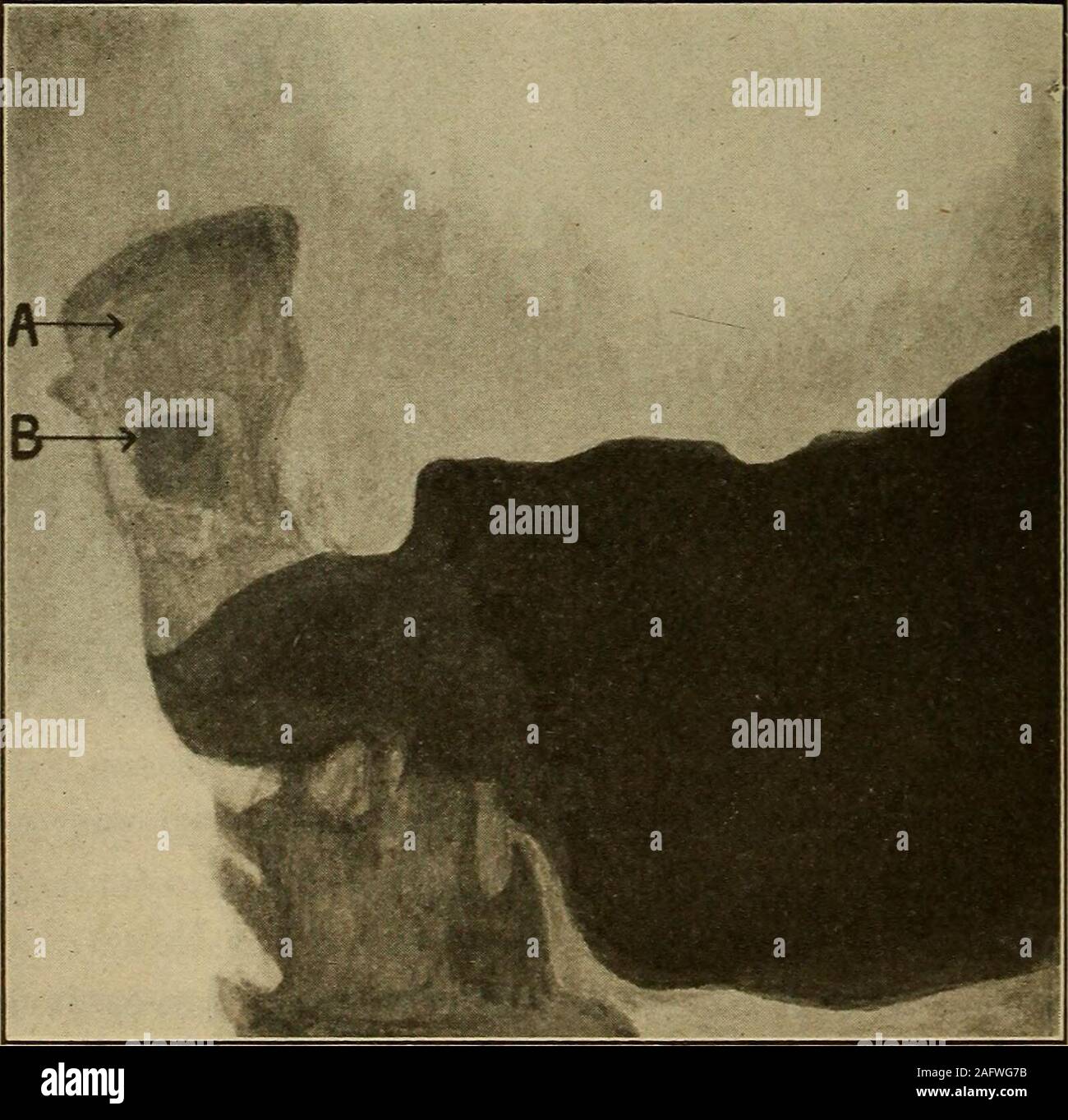 . Medical diagnosis for the student and practitioner. Fig. 468. Fig ...