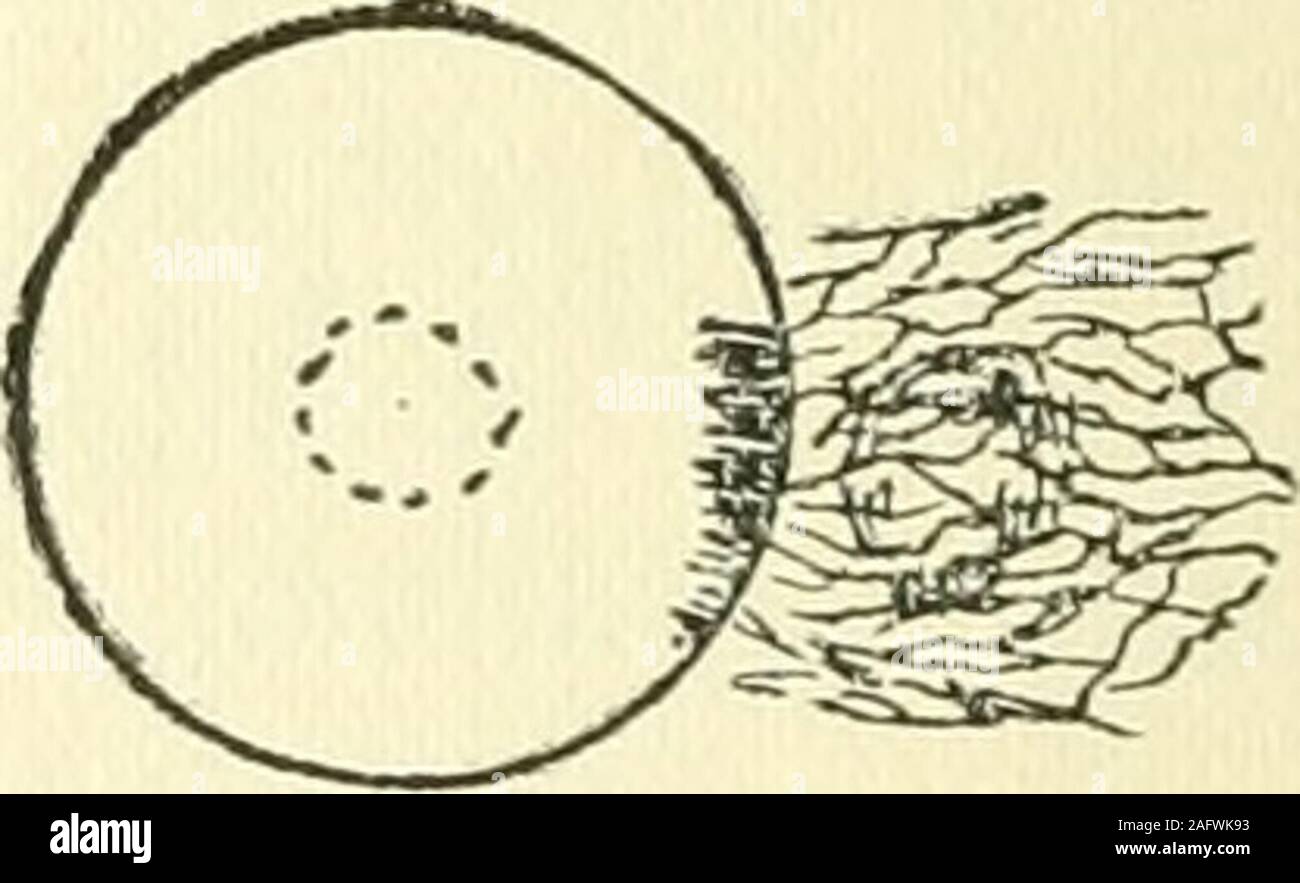 . Oftalmología; estadística [1.]-3. ser. Fig. 127. — Esclero ...