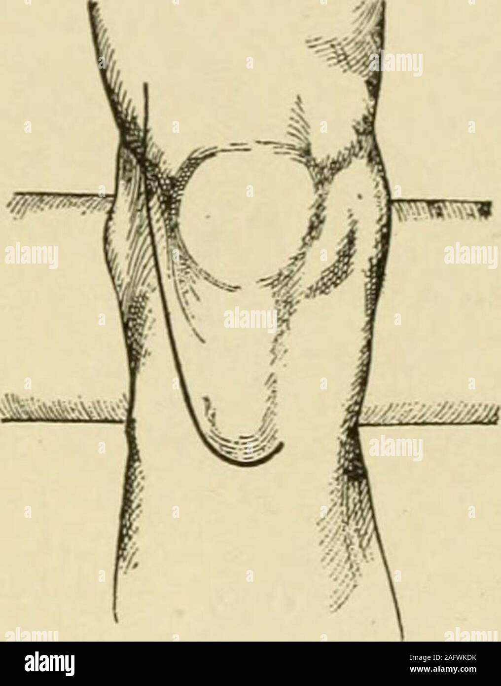 Manual operative surgery tendon hi-res stock photography and images - Alamy