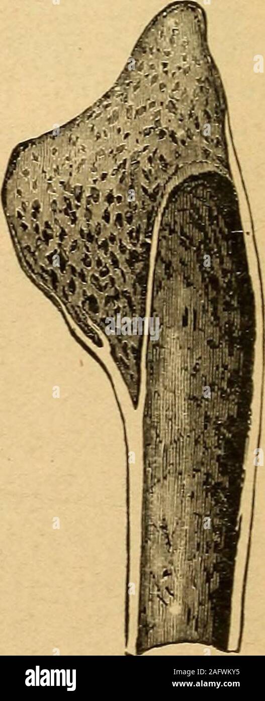 Separation of the neck bones hi-res stock photography and images - Alamy