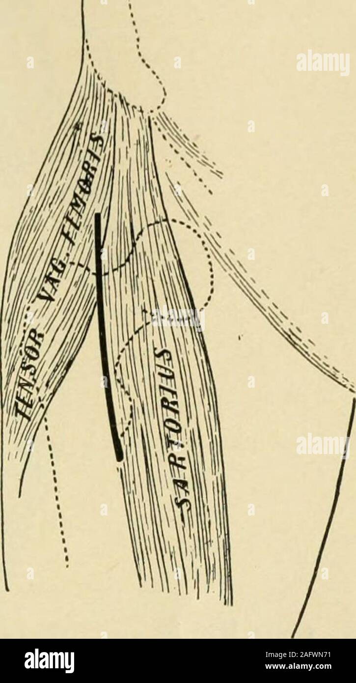 . Manual of operative surgery. device may be used.) (C) Systematized ...