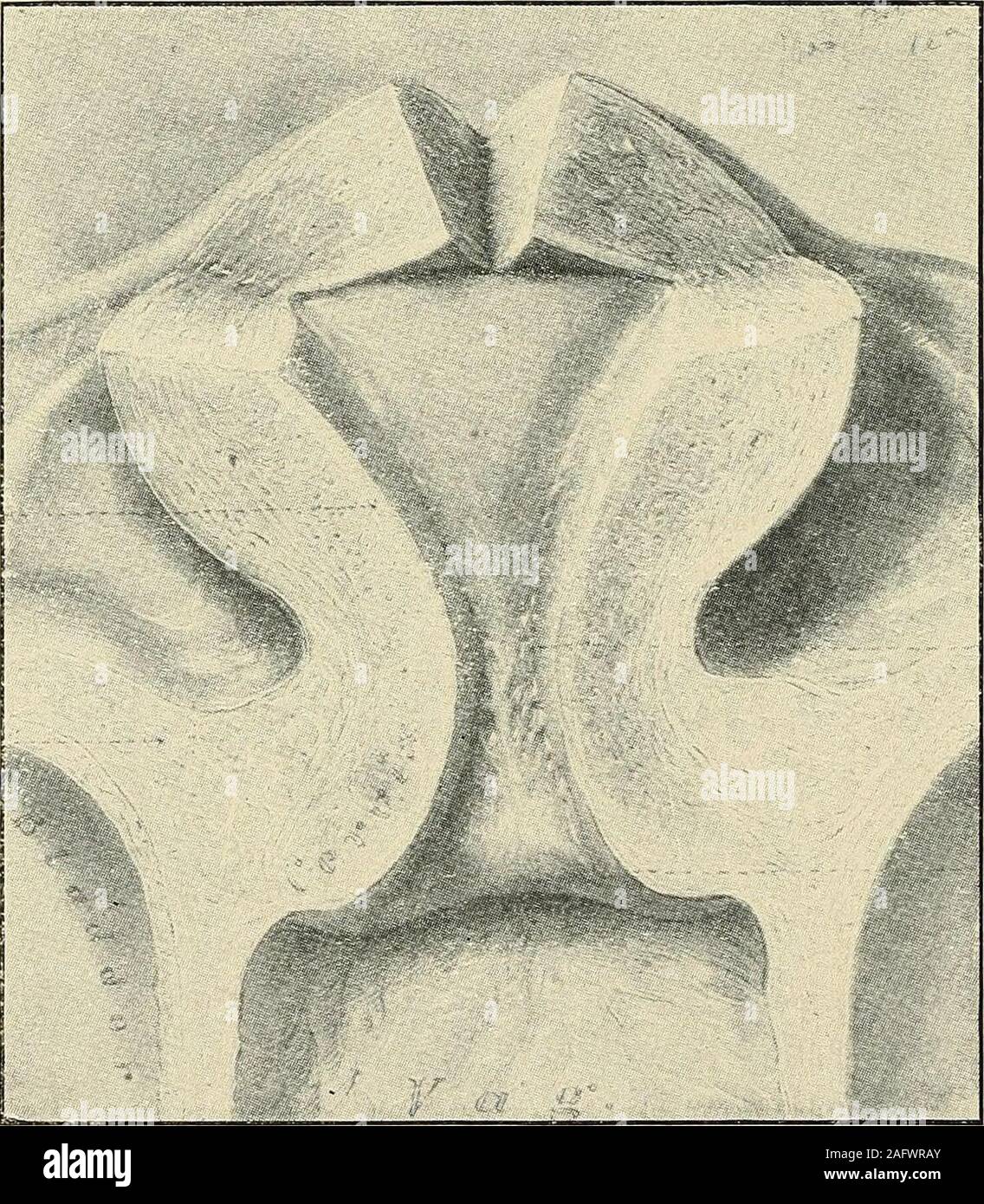 . The diagnosis and treatment of diseases of women. tion of the mucosa ...