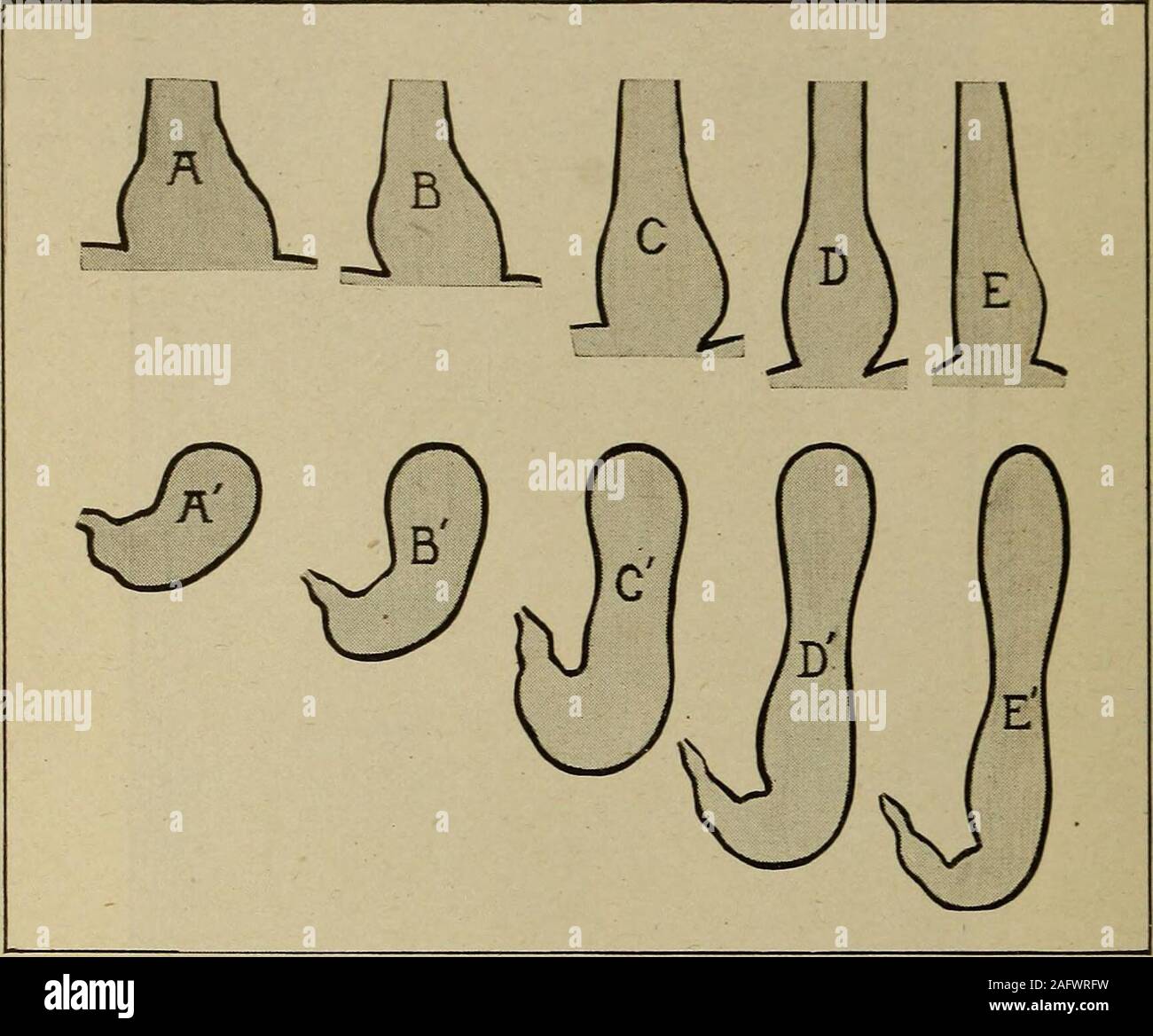 . Medical diagnosis for the student and practitioner. Fig. 453.—Dilated ...