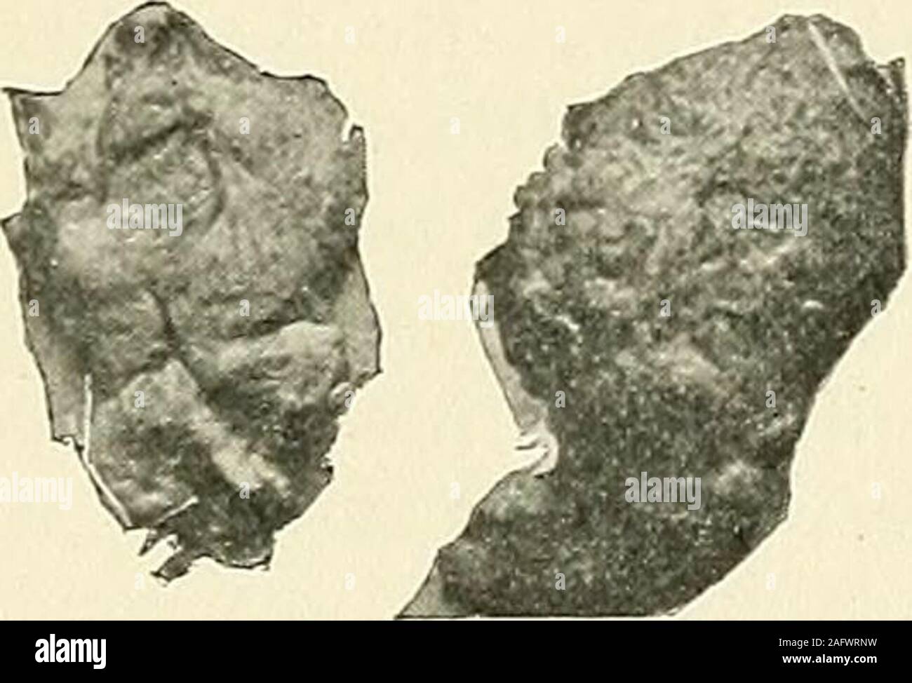 . Studies on hypertrophy and cancer of the prostate. Fig. 56.—Small ...
