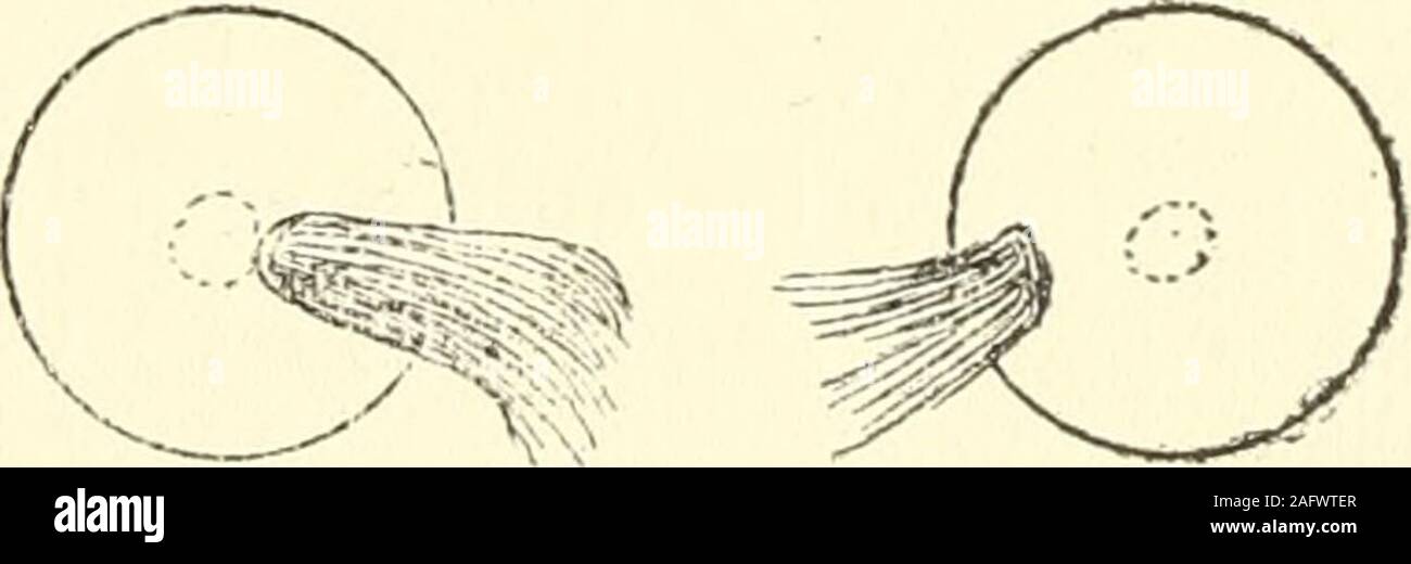 . Oftalmología; estadística [1.]-3. ser. Fig. 34.—Pterygiones interno y ...