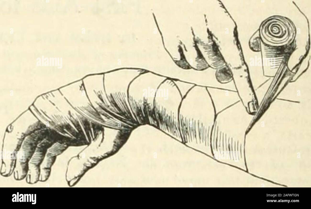 Foreign object damage hi-res stock photography and images - Alamy