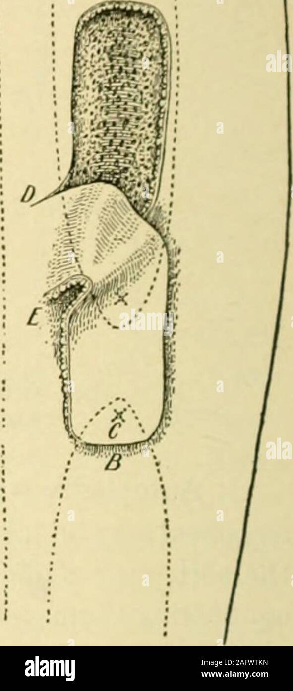 . Manual of operative surgery. Fig. ioSo. Fig. 1081. Figs. 1080 and ...