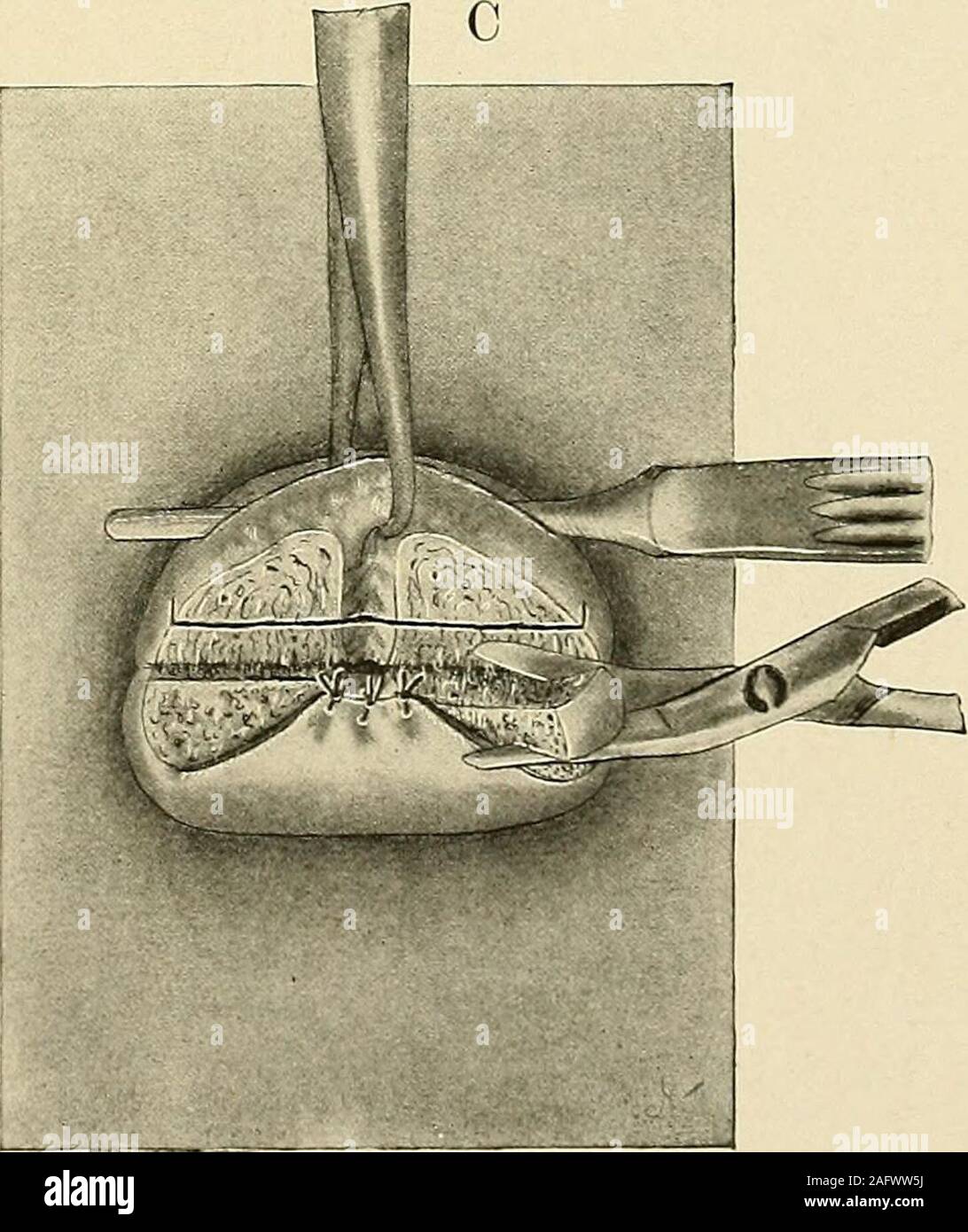 . The diagnosis and treatment of diseases of women. Fig. 562. Parti.ll ...
