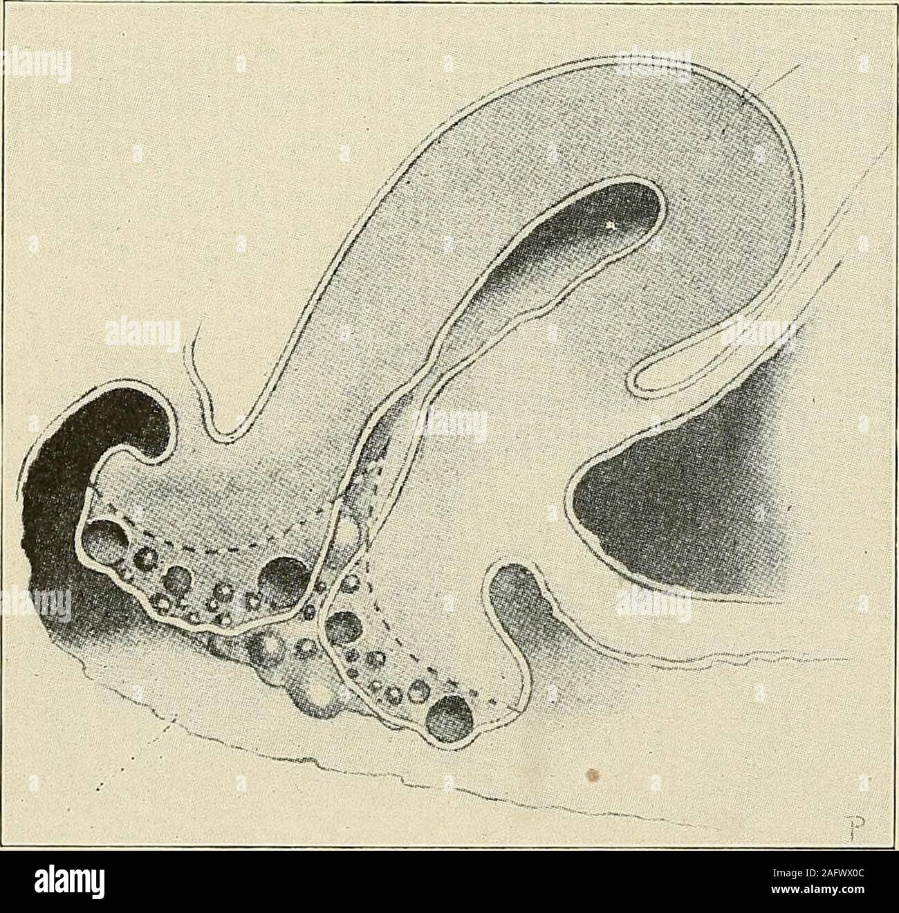 . The diagnosis and treatment of diseases of women. Pig. 659. Cross ...