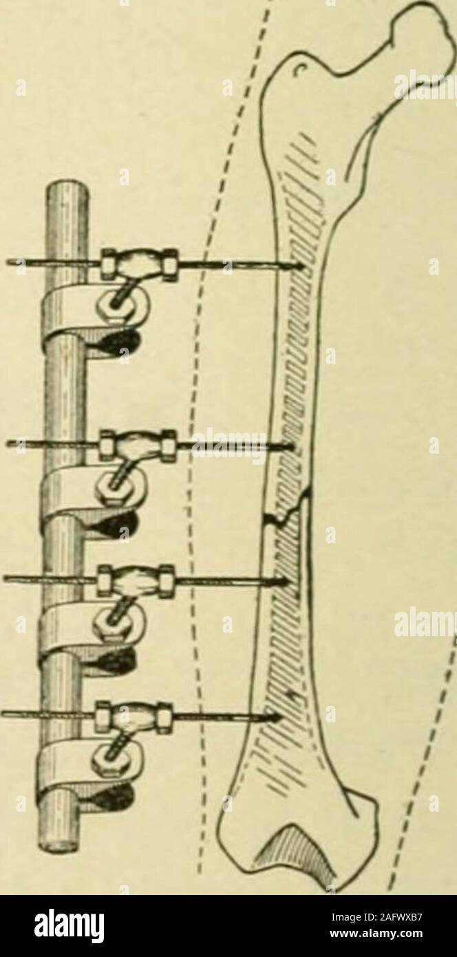 Physio fish hi-res stock photography and images - Alamy
