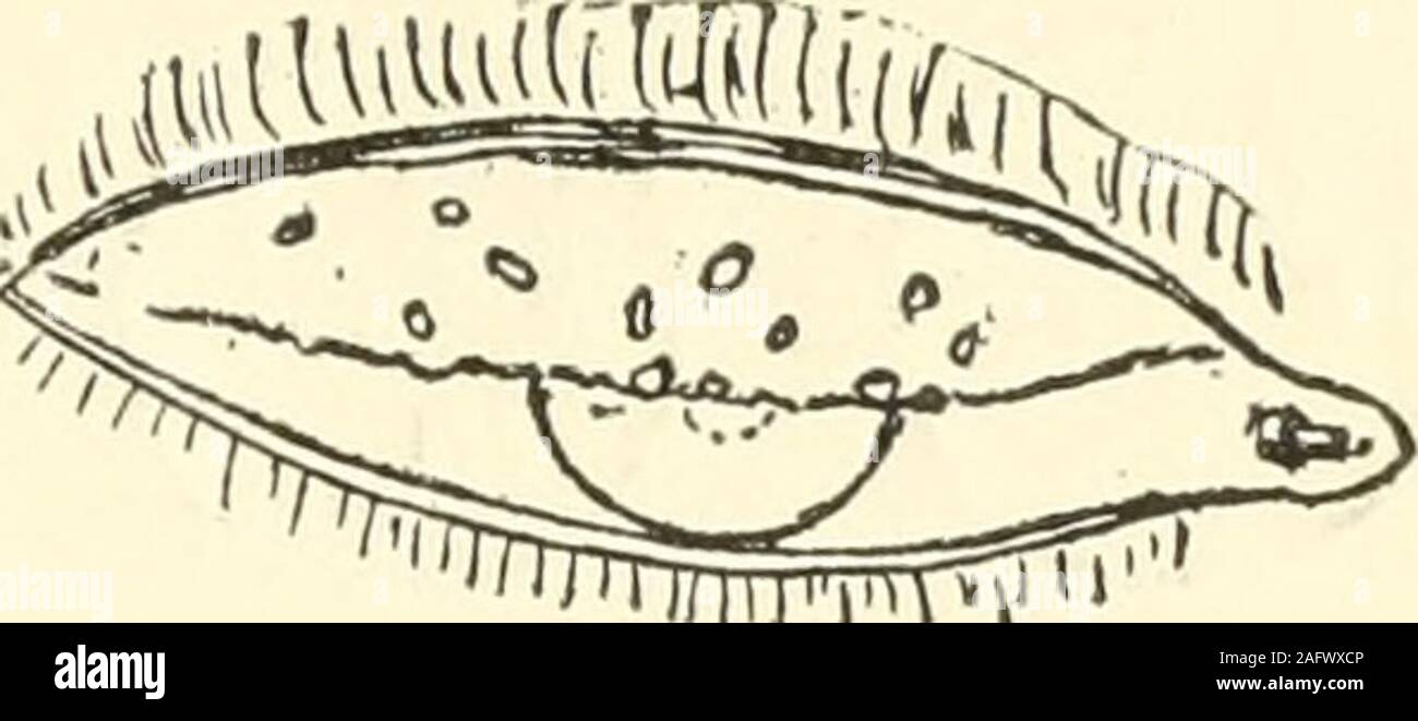 Tracoma hi-res stock photography and images - Alamy